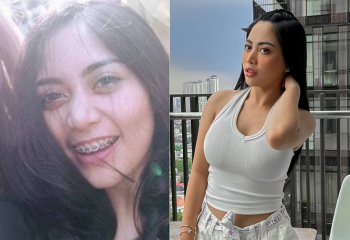 5 Potret Rachel Vennya Dulu Vs Sekarang, Tetap Seperti ABG Meski Sudah ...