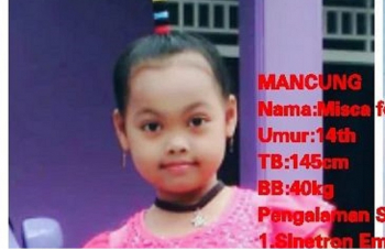 Potret Terkini Misca Fortuna, Artis Cilik Fenomenal yang Dikenal Sebagai Si Mancung | News+ on RCTI+